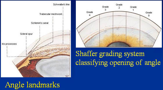 Intraocular Pressure (IOP)