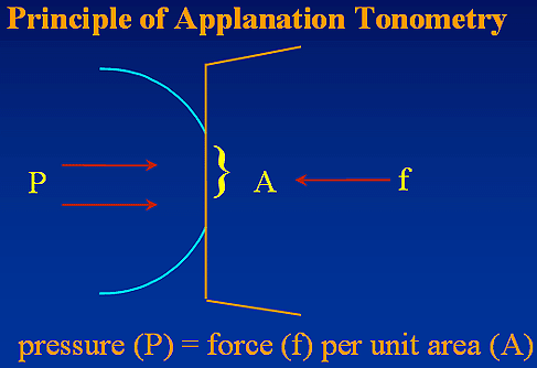 Intraocular Pressure (IOP)