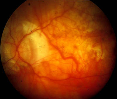 On-Line Ophthalmology Teaching: Introduction